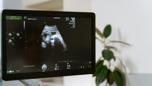 Duplex Ultrasonography | Venous & Carotid Doppler | Tarlac Medical Center