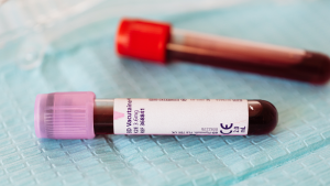 Prothrombin Time (PT/INR) Blood Test | Tarlac Medical Center
